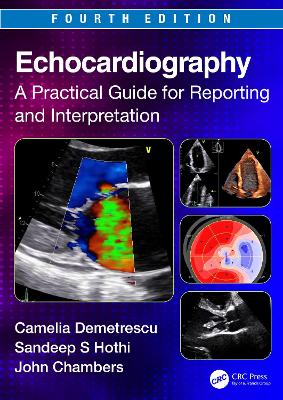 Echocardiography by Camelia Demetrescu, Sandeep S. Hothi | Waterstones