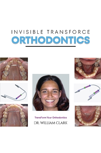 Invisible TransForce Orthodontics by Dr. William Clark | Waterstones