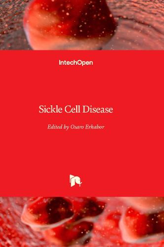 Sickle Cell Disease by Osaro Erhabor | Waterstones