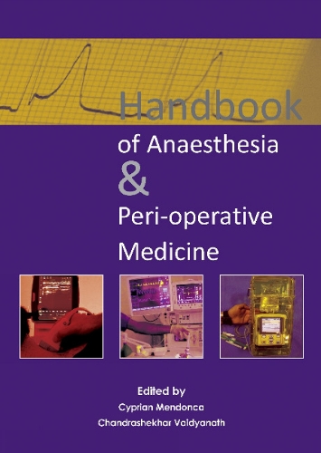Handbook of Anaesthesia & Peri-operative Medicine by Dr Dr Cyprian ...