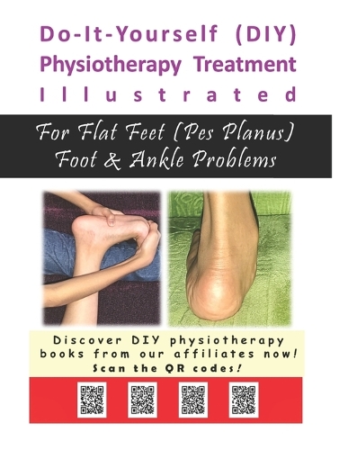Physiotherapy Treatment Illustrated For Flat Feet (Pes Planus) Foot ...