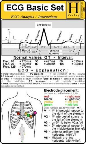 ECG Basic Set: ECG Ruler and Cardiac Arrhythmia and ECG by Verlag ...