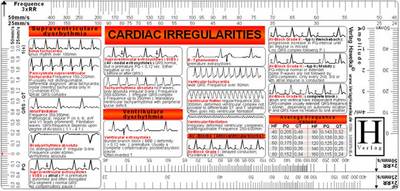 ECG Ruler - Cardiac Arrhythmia by Verlag Hawelka | Waterstones