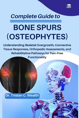 Complete Guide to Bone Spurs (Osteophytes) by Dr Tristan C Wealth ...