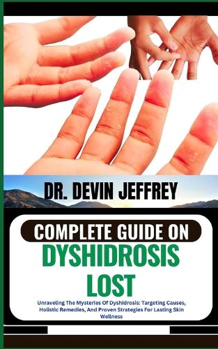 Complete Guide on Dyshidrosis Lost by Dr Devin Jeffrey | Waterstones